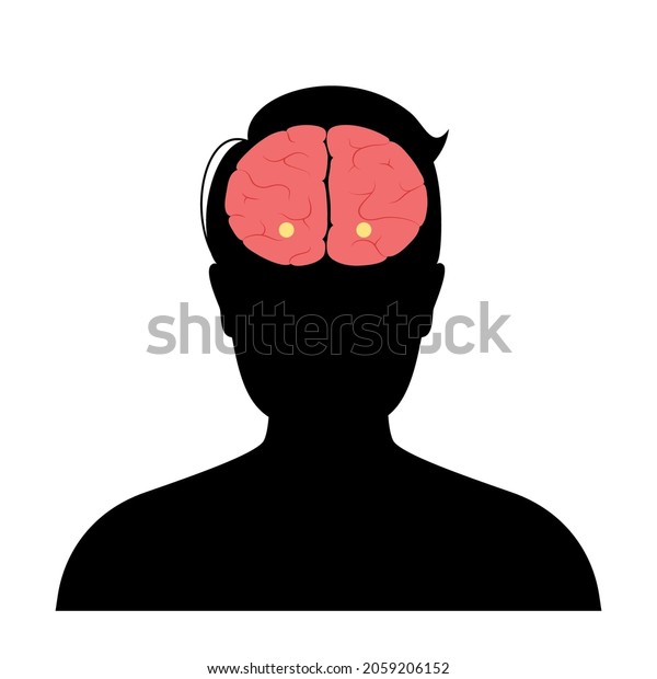Amygdala Limbic System Concept Human Brain Stock Vector (Royalty Free ...