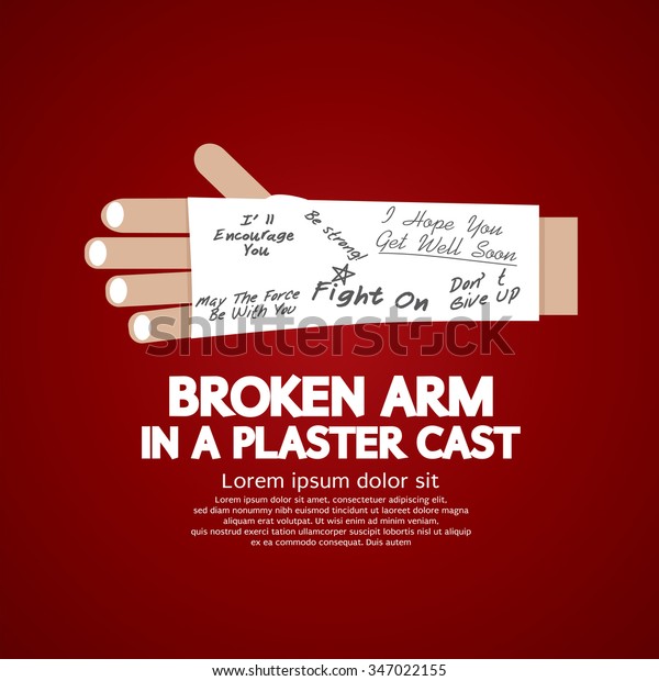 Broken Wrist Cast: Over 594 Royalty-Free Licensable Stock Illustrations ...
