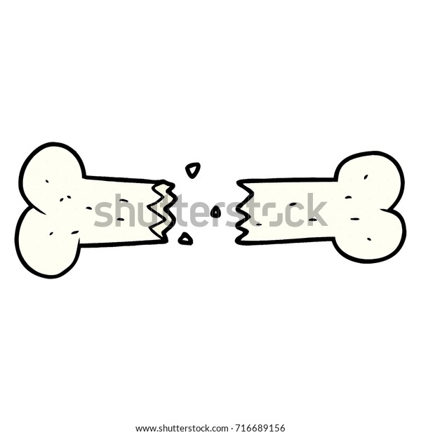 Broken Bone Cartoon Stock Vector (Royalty Free) 716689156 | Shutterstock