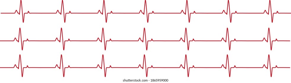 Ecg Electrocardiogram Show Heart Beat Line Stock Vector (Royalty Free ...