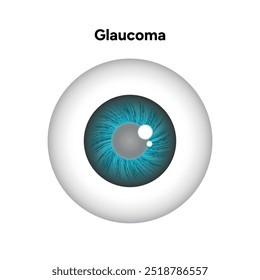 Eye Structure Defect Eye Glaucoma Anatomy Stock Vector (Royalty Free ...