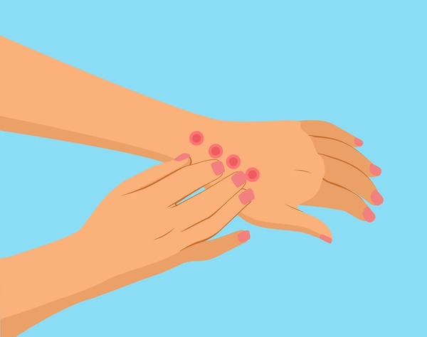 8,003 Bug Bite Cartoon Royalty-Free Images, Stock Photos & Pictures ...