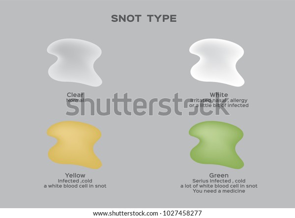 Sinus Yellow Snot: Over 5 Royalty-Free Licensable Stock Illustrations ...