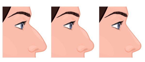 50 Arabic Woman Before After Images, Stock Photos, 3D objects ...