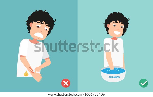 Cooling Burns: Over 19,625 Royalty-Free Licensable Stock Illustrations ...