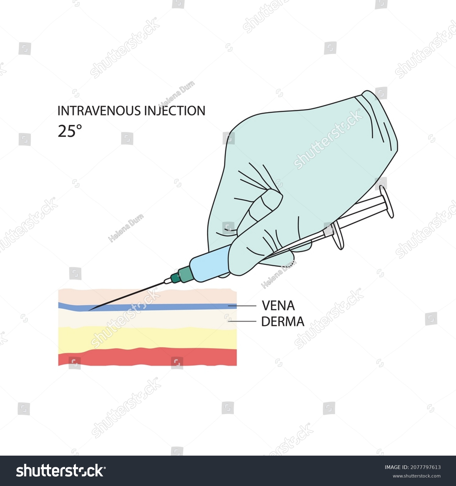 Intravenous Injection Effective Methods Administration Drugs Stock Vector Royalty Free