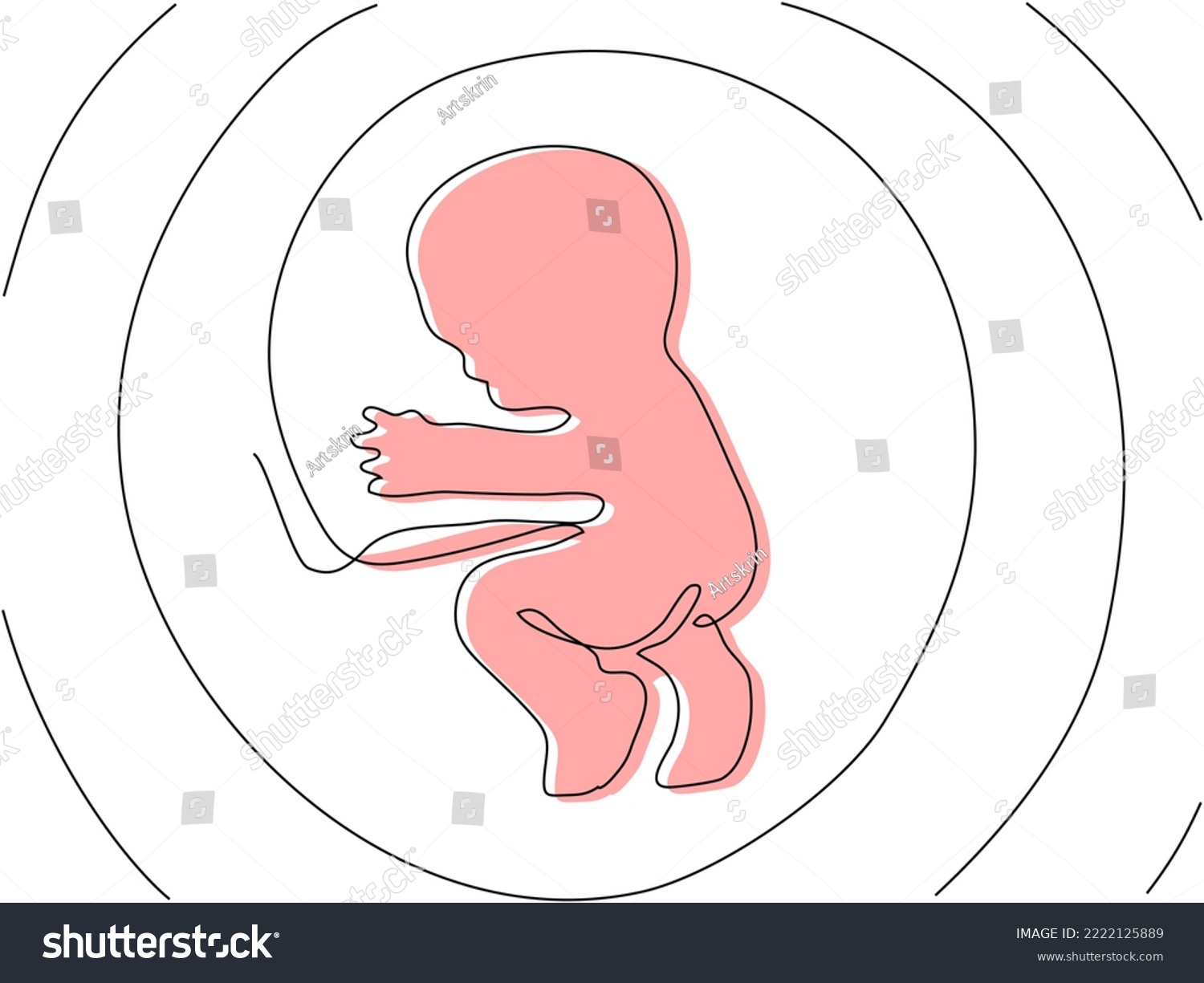 Fetus Outline
