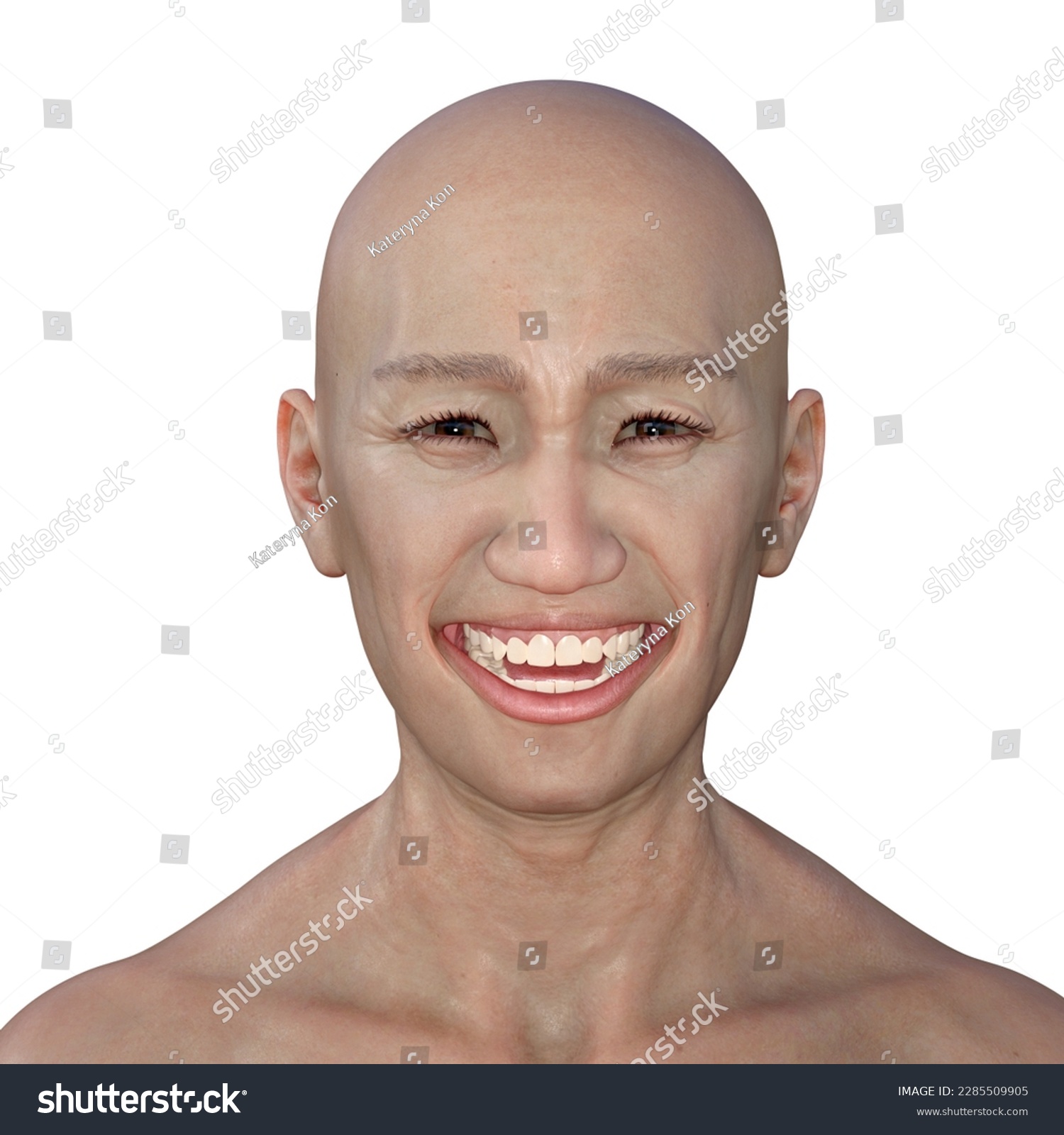 What Is Lockjaw In Arabic at Corazon Stafford blog