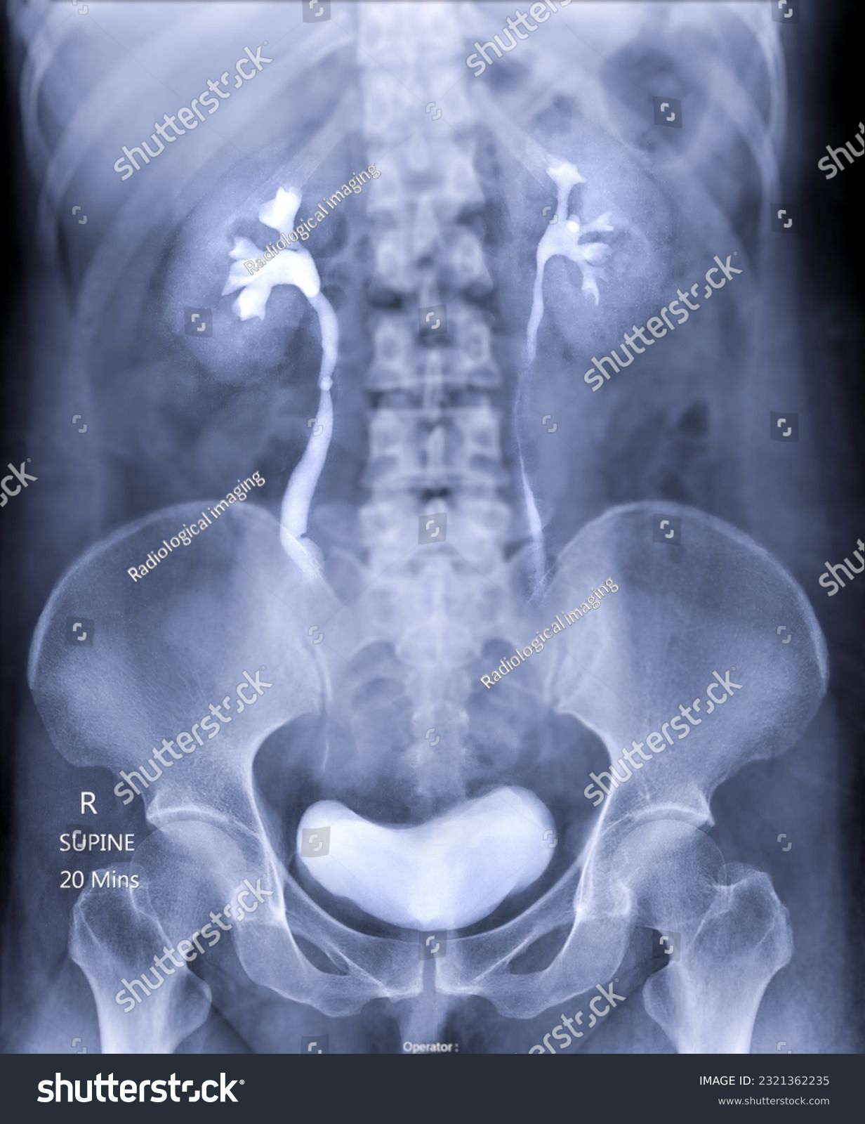 Contran: Over 765,636 Royalty-Free Licensable Stock Photos | Shutterstock